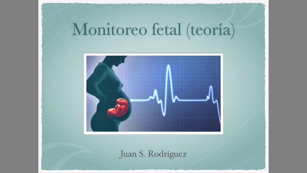 Todo lo que Necesitas Saber sobre el Monitoreo Fetal: Guía Completa y ...