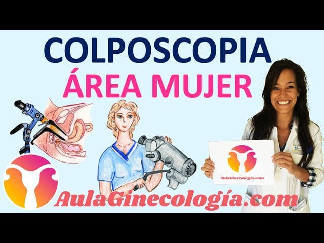 Todo lo que Necesitas Saber sobre la Colposcopia: Guía Completa y ...